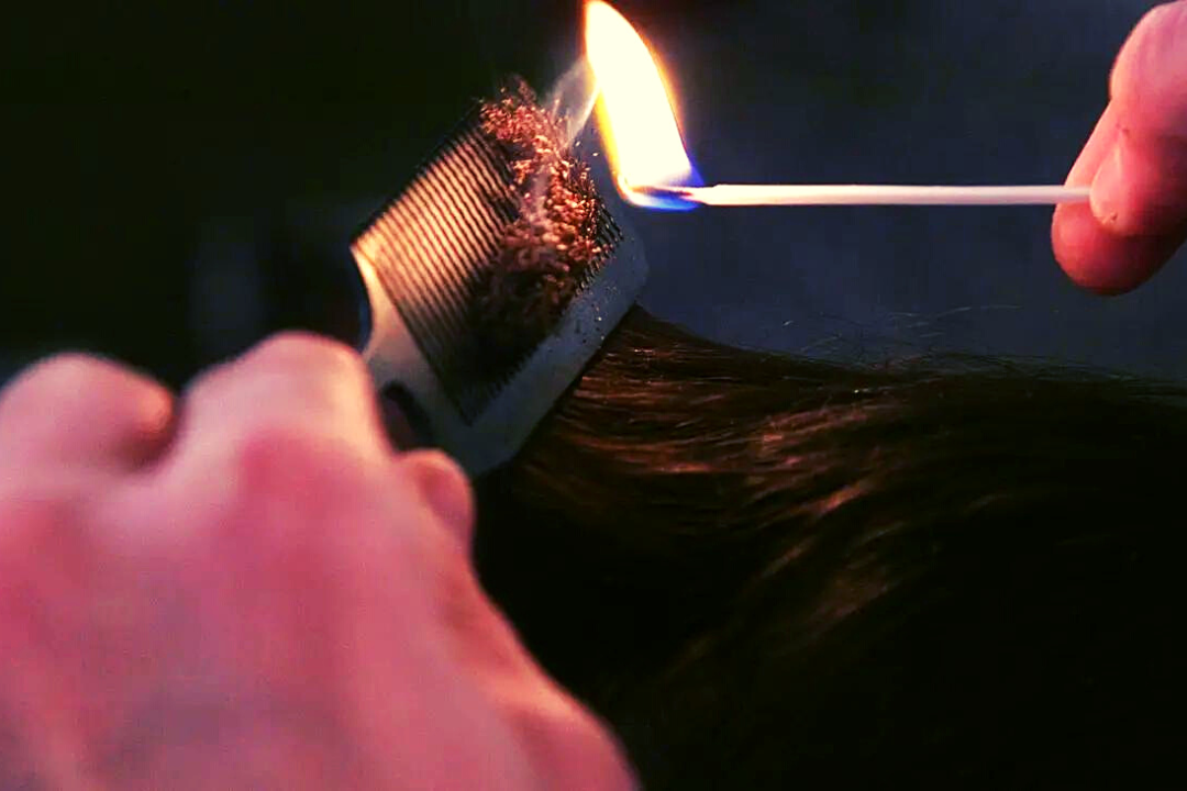 Haircut gone to ashes, literally as Surat mans get burnt during hairstyling